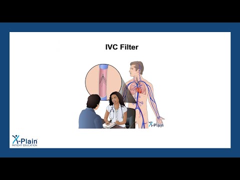 IVC Filter