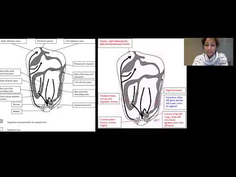 Retained products of conception or uterine AVM?? Dr. Aarti Sekhar