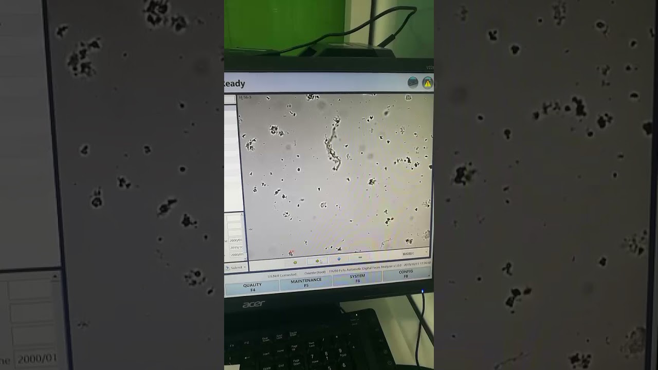 Parasite Identification Using AI
