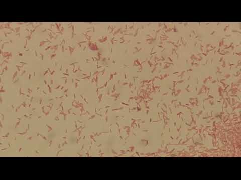 Moraganella morganii in Gram Staining