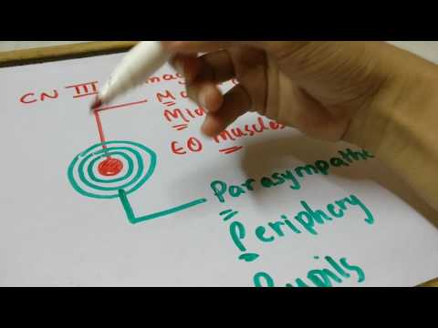 Cranial nerve III damage (Oculomotor nerve damage mnemonic)