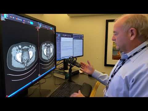 Dr. Folio give description of PACS
