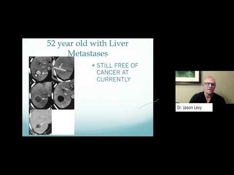 Interventional Radiology in Cancer Treatment