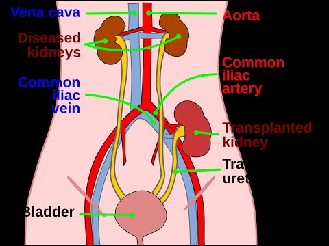 Kidney Transplantation CPT codes - simplify medical coding
