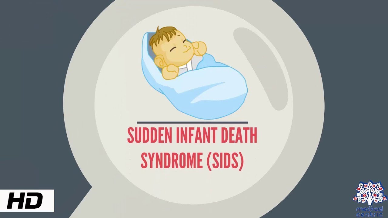 Sudden Infant Death syndrome, Causes and Prevention