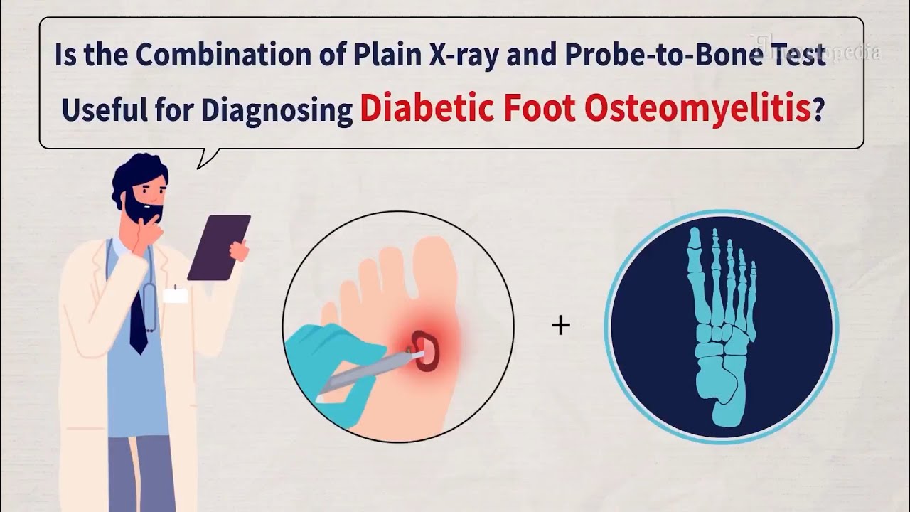 【JCM】Combination of Plain X-ray and Probe-to-Bone for Diagnosing Diabetic Foot Osteomyelitis