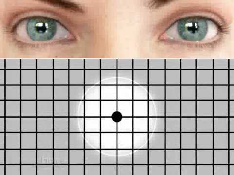 Benefits of the ForeseeHome vs. the Amsler Grid