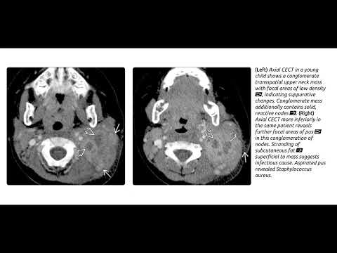 Head and neck radiology diagnostic imaging series images only(2)
