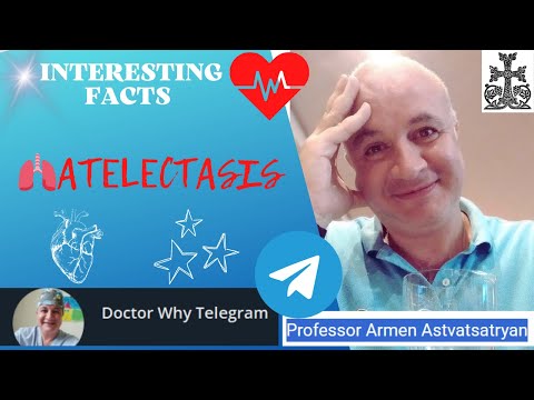 What is ATELECTASIS of the lungs? Lung Collapse!