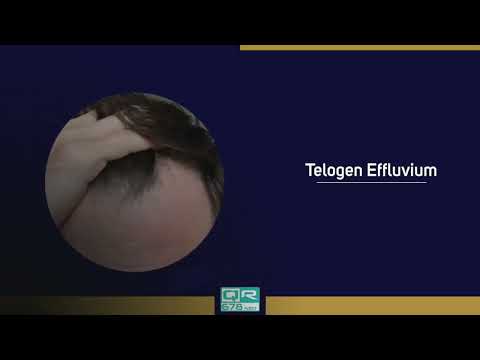 Qr678 Neo - A revolutionary treatment for hair loss