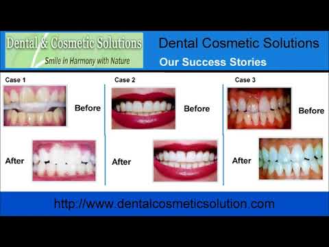 Dental And Cosmetic Solutions in Cleveland, OH