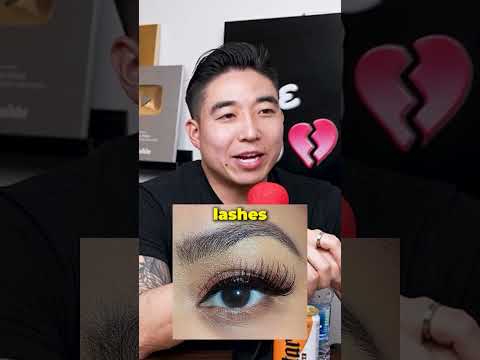What is an ABG? (Checklist)