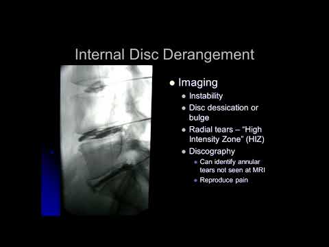 Imaging of Basics of spine injury