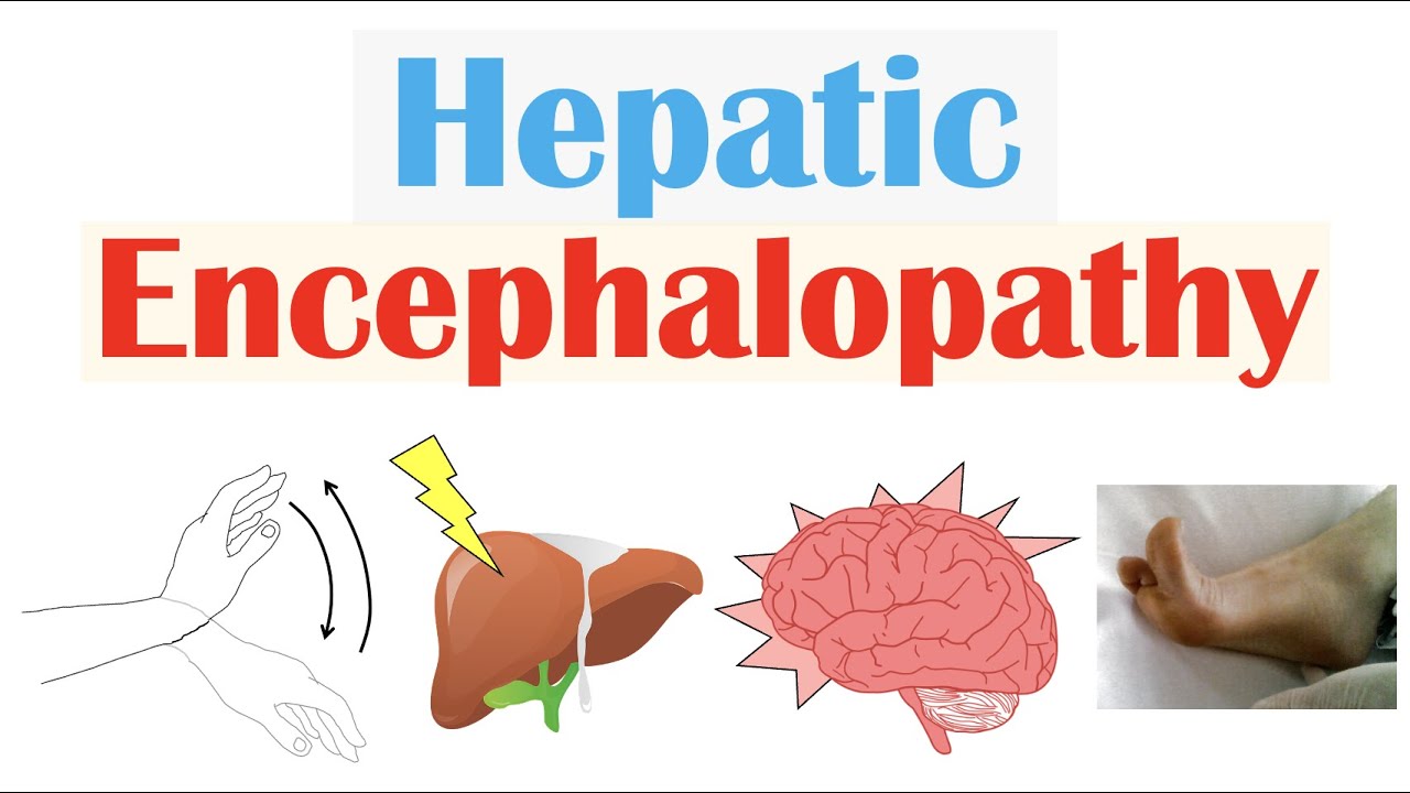 Understanding Hepatic Encephalopathy: Pathophysiology, Symptoms ...