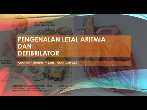 Pengenalan Aritmia yang Mengancam Jiwa (Letal Aritmia)