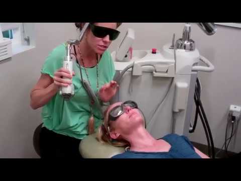Halo: For total skin rejuvenation