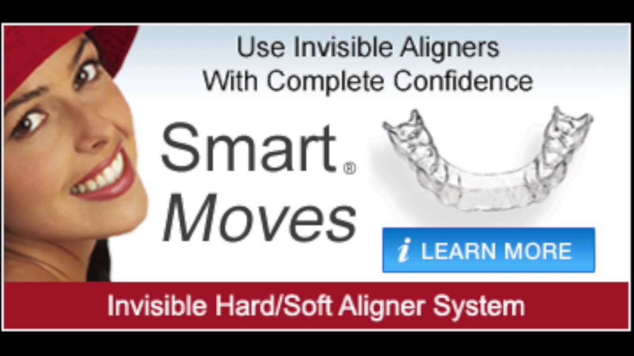 Introducing Smart Moves