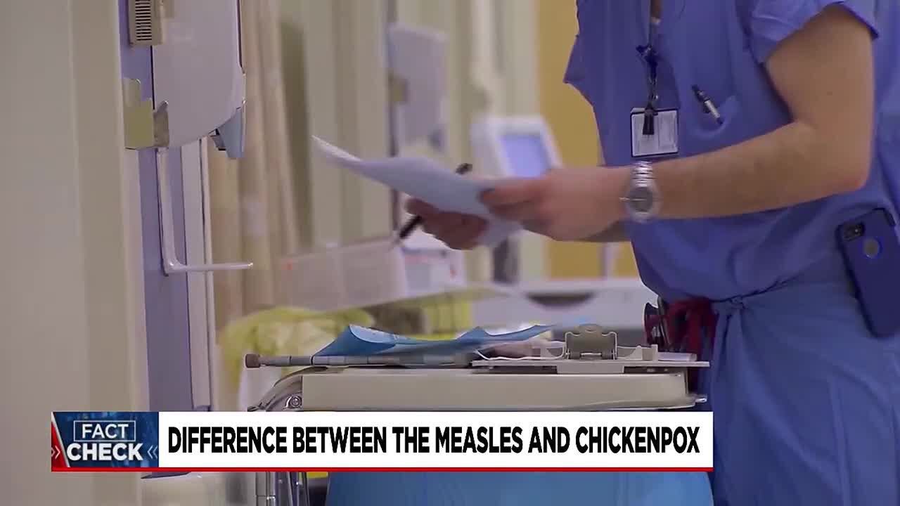 Knowing the difference between measles and chickenpox