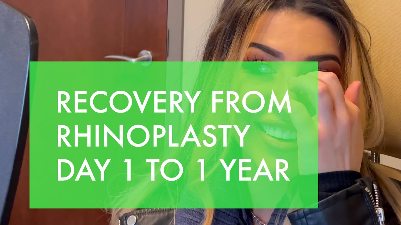 Revision Rhinoplasty Recovery | Seattle WA | Joseph Shvidler MD