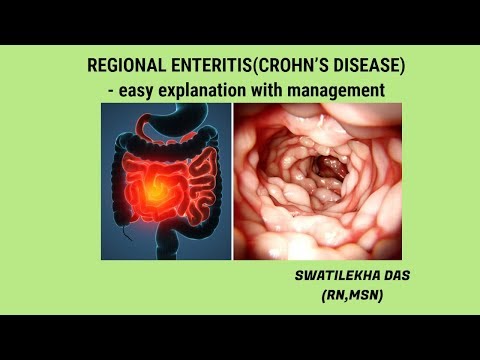 What is Crohn's Disease?- easy explanation with management