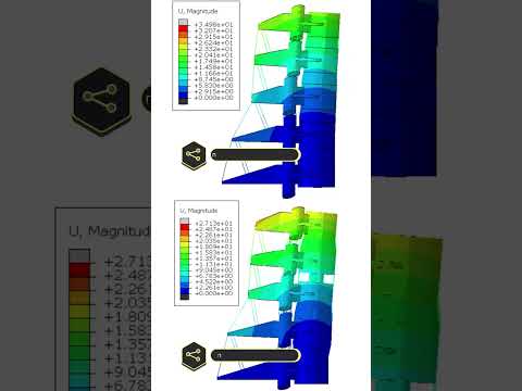 Biomechanical Analysis of Cervical Spine: Pre- and Post-Fusion Surgery Insights