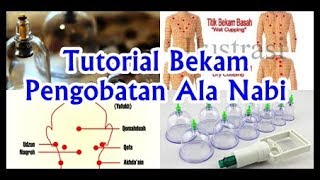 benarfuzziblog: Titik Bekam Yang Benar