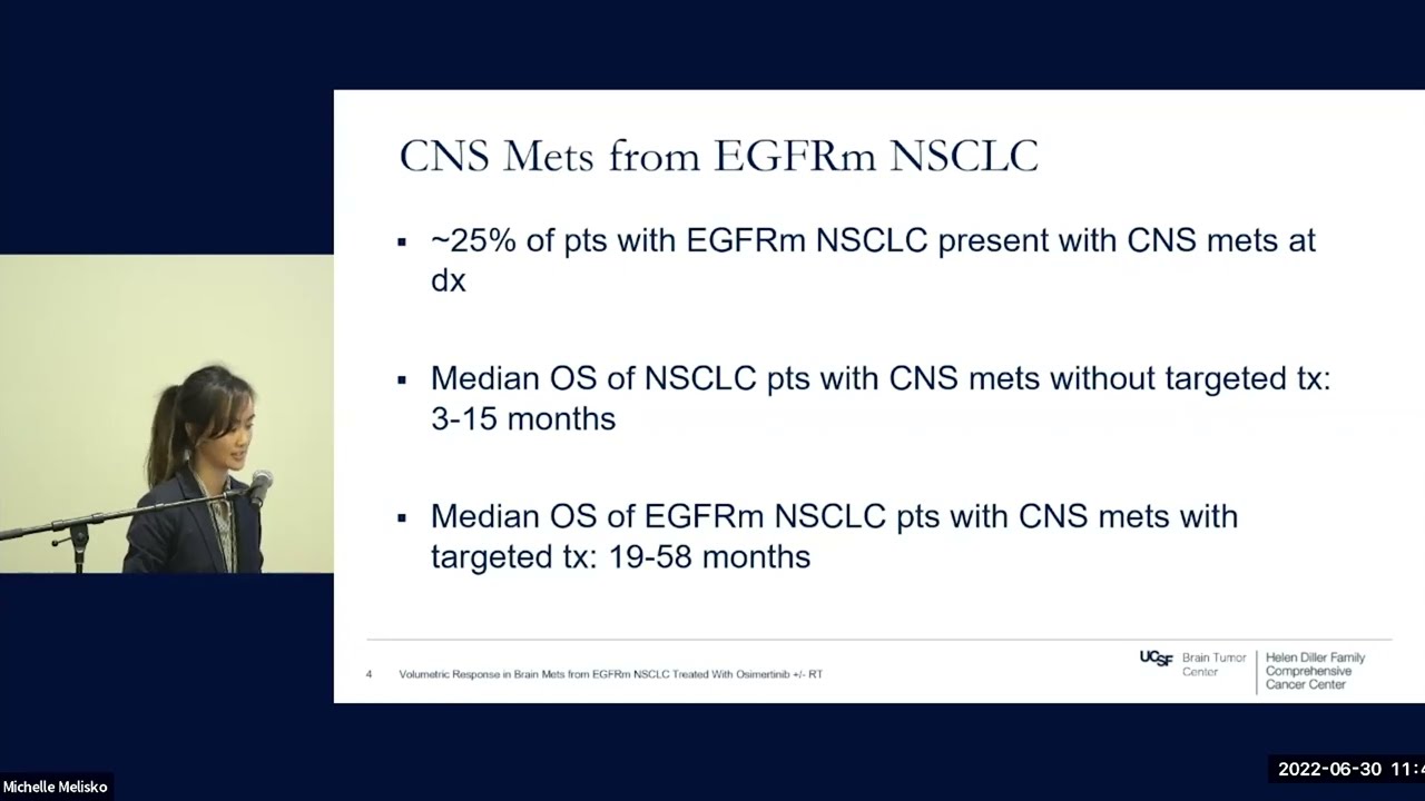 Volumetric Response of Brain Metastases in EGFR mutant NSCLC | Lisa Ni, MD