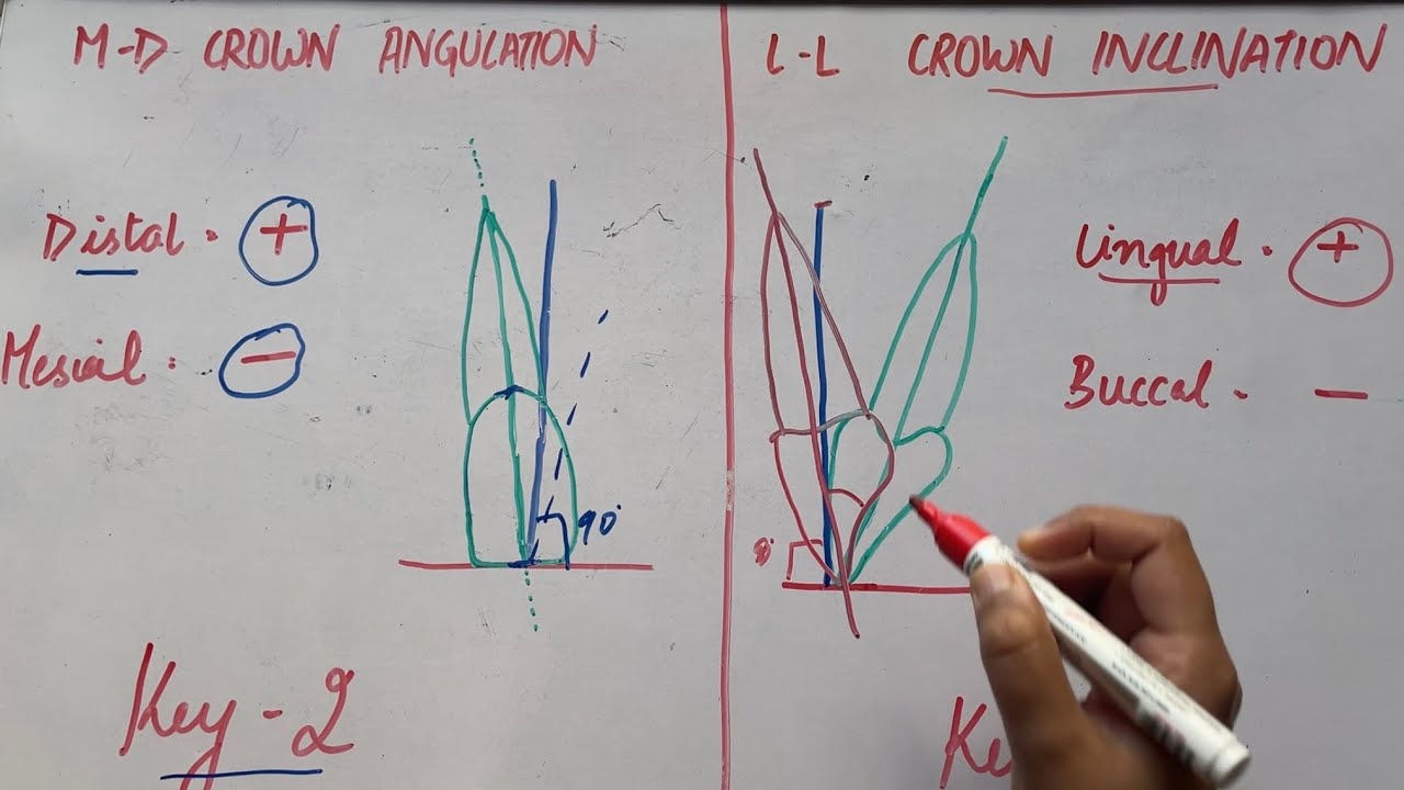 Andrews' Six Keys of Normal Occlusion | Basic Concepts of Occlusion