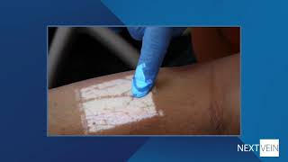 NextVein Handheld Vein Visualization Finder System V800NV