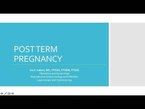 Postterm pregnancy