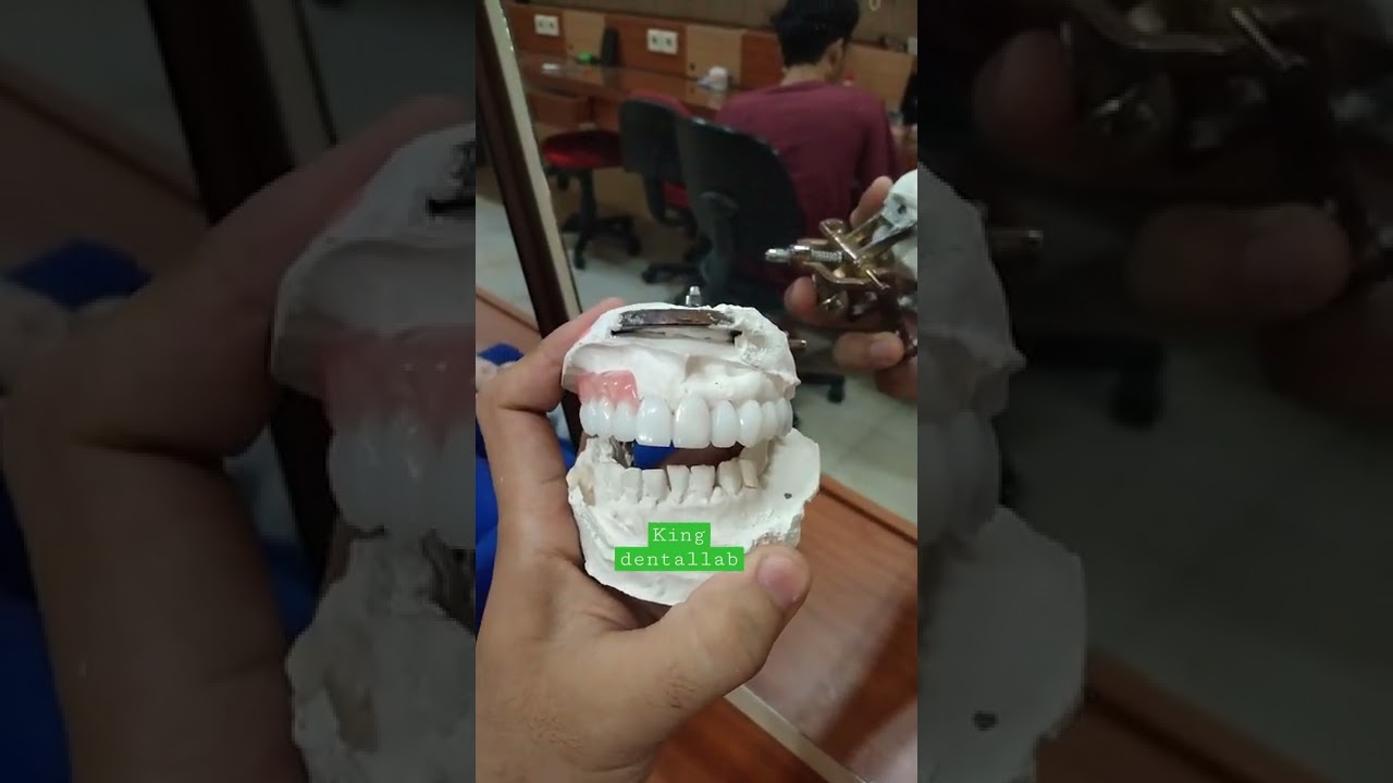 SNAP ON gigi paling putih king dental lab gigi palsu lepasan