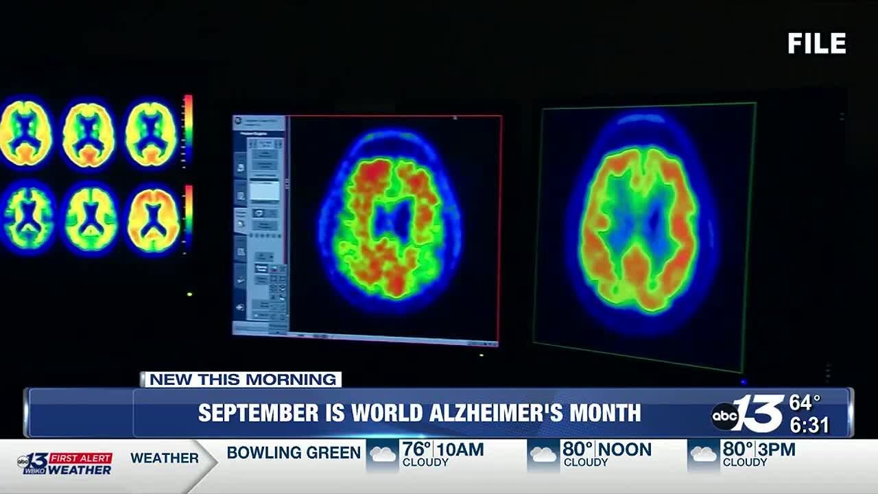 Bowling Green neurologist discusses signs and symptoms of Alzheimer's