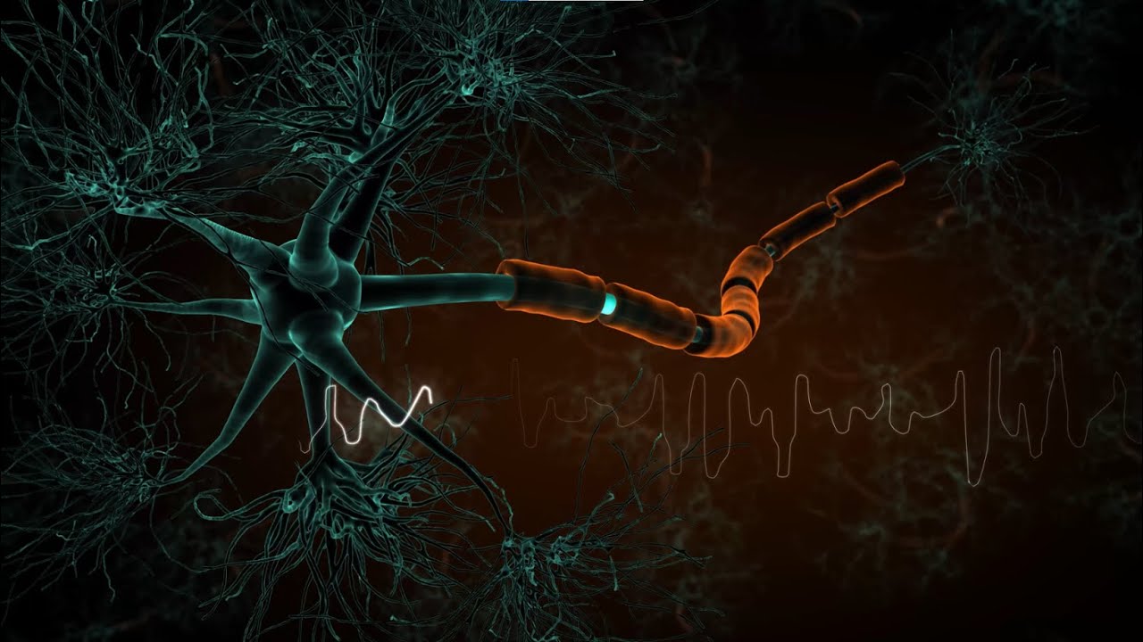Understanding multiple sclerosis (MS) and the role of NfL testing with a simple blood test