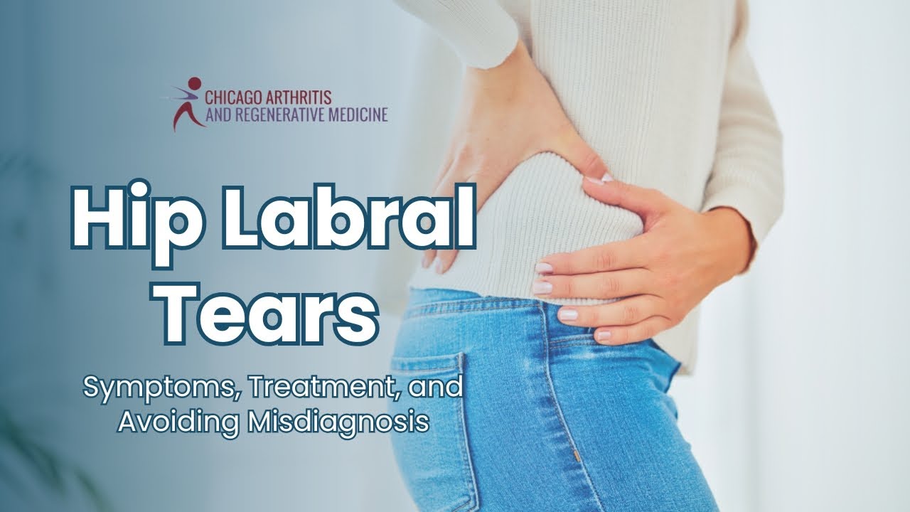 Hip Labral Tears: Symptoms, Treatment, and Avoiding Misdiagnosis - Chicago Arthritis and ...