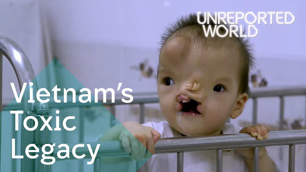 The Vietnam War's Agent Orange legacy | Unreported World