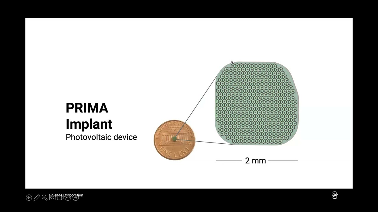 The PRIMA Implant for Vision Restoration