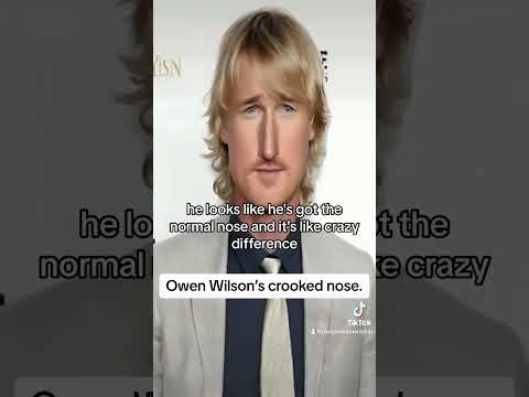 Owen Wilson’s crooked nose. Meet the Fockers. Behind enemy lines.