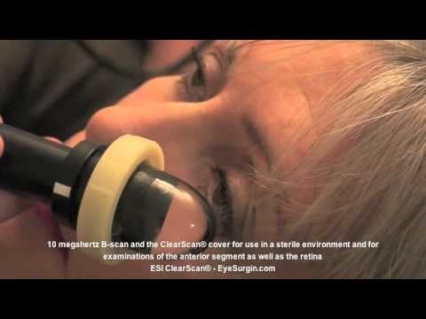 ESI Part 04 - B-scan and the Clearscan® examinations of the anterior segment and retina