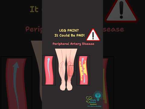 Peripheral Artery Disease (PAD) Explained in 60 Seconds | Symptoms, Diagnosis & Treatment