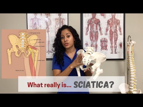 Sciatic Nerve Pain? What REALLY is sciatica?