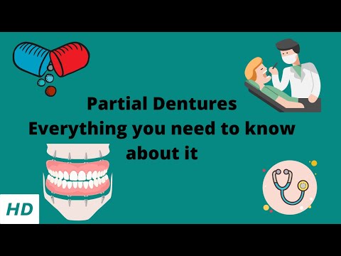 PARTIAL DENTURE: Everything you need to know about them