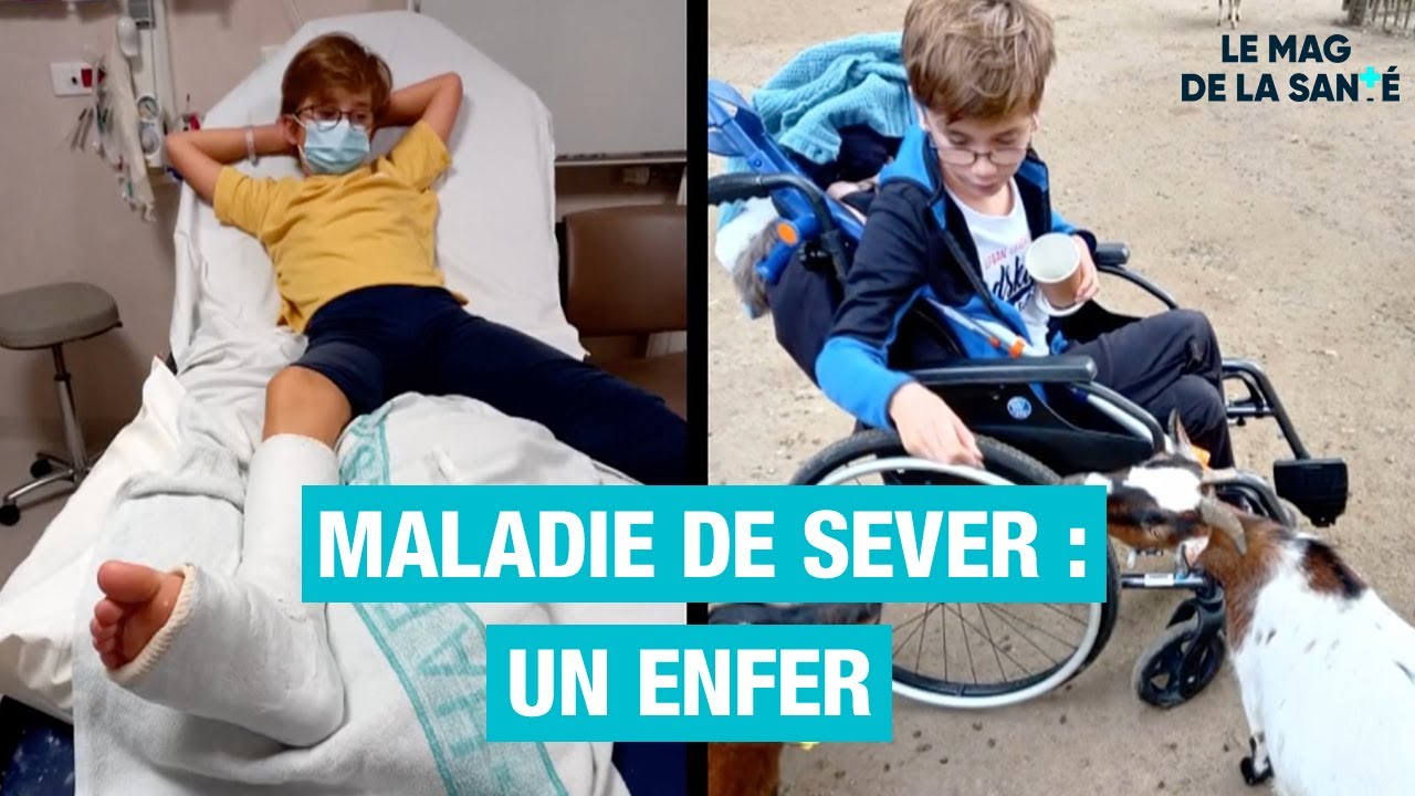 Documentaire | La maladie de Sever chez les enfants