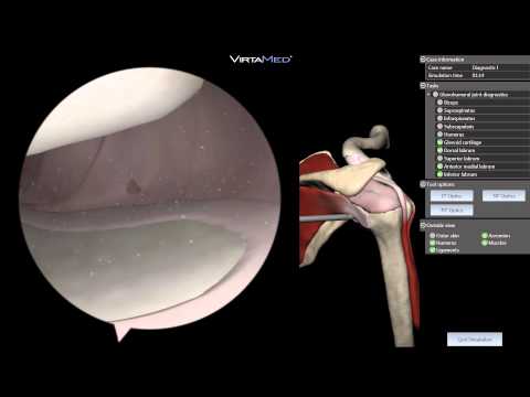 Arthroscopy Training Simulator ArthroS Now With Shoulder Module!