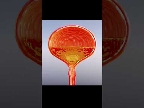 ???? Understanding Interstitial Cystitis (painful bladder)