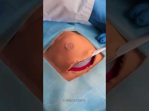 The truth behind this medical procedure 🦷❤️