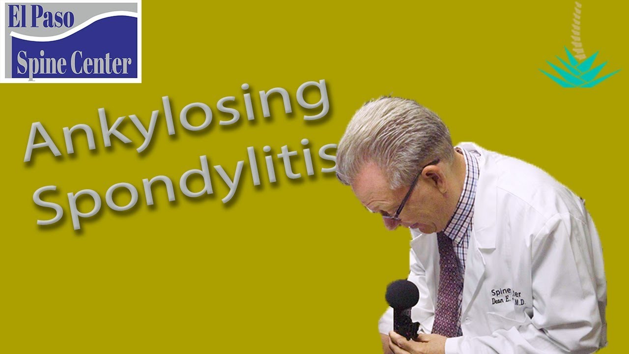 Medical Minute | What is Ankylosing Spondylitis?