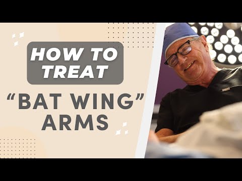 Saggy Arms? Here’s How to Fix “Bat Wings”