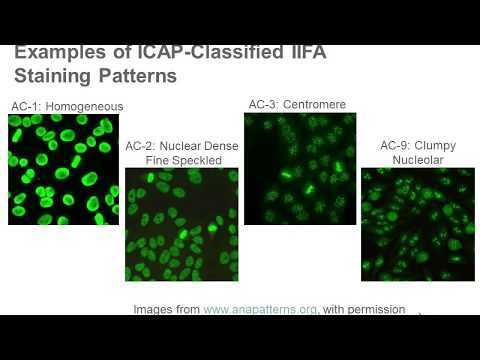 Antinuclear Antibody Testing