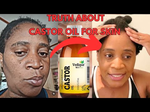 Castor Oil for your face shocking Truth About Castor Oil On The Skin/ Benefits Of Castor Oil