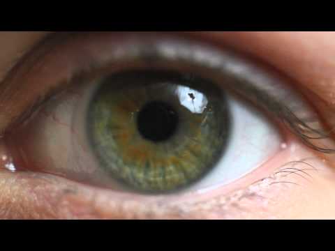 Darling Pet Munkee – X-Ray Specs – Apollo Lemmon